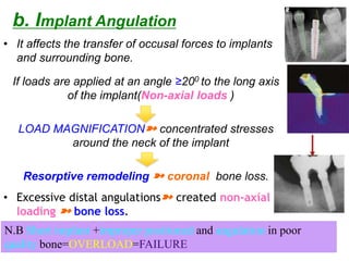 Treatment plan and biological consideration of implants | PPT