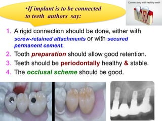 Treatment plan and biological consideration of implants | PPT
