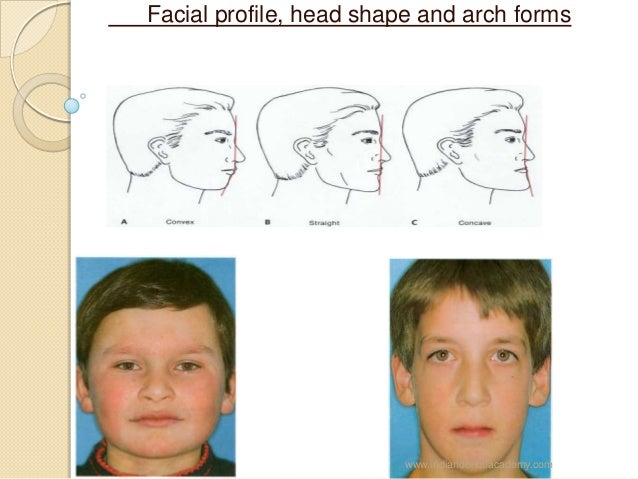 Treatment planning /certified fixed orthodontic courses by Indian