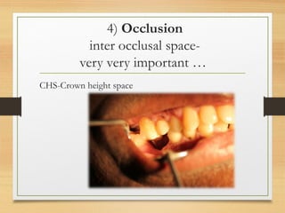 Treatment planning for basal implants | PPT