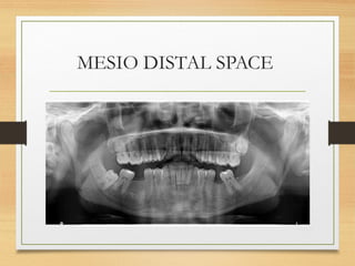 Treatment planning for basal implants | PPT