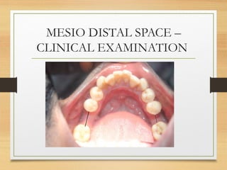 Treatment planning for basal implants | PPT