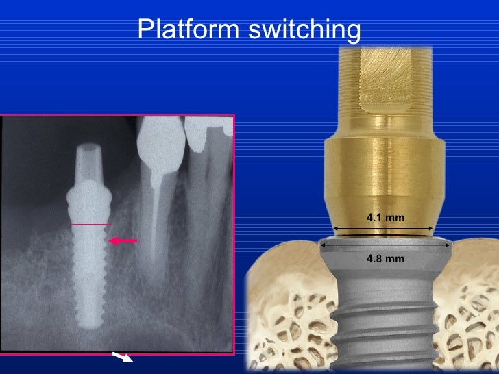 Treatment Planning pt. 7-8