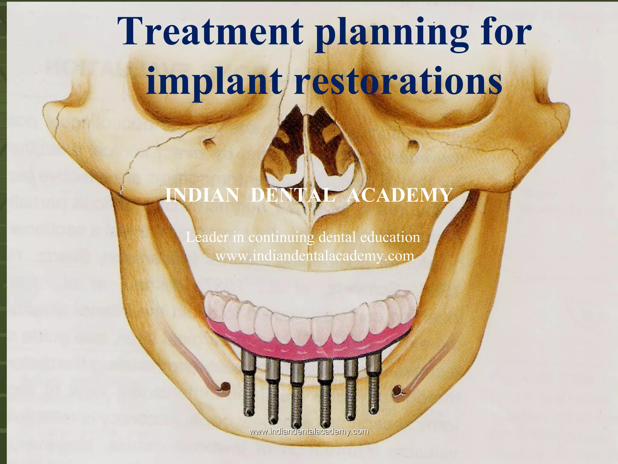 Treatment planning for dental implants/fixed orthodontics courses | PPT