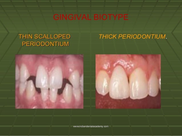 Treatment planning for implants raju/ dental courses