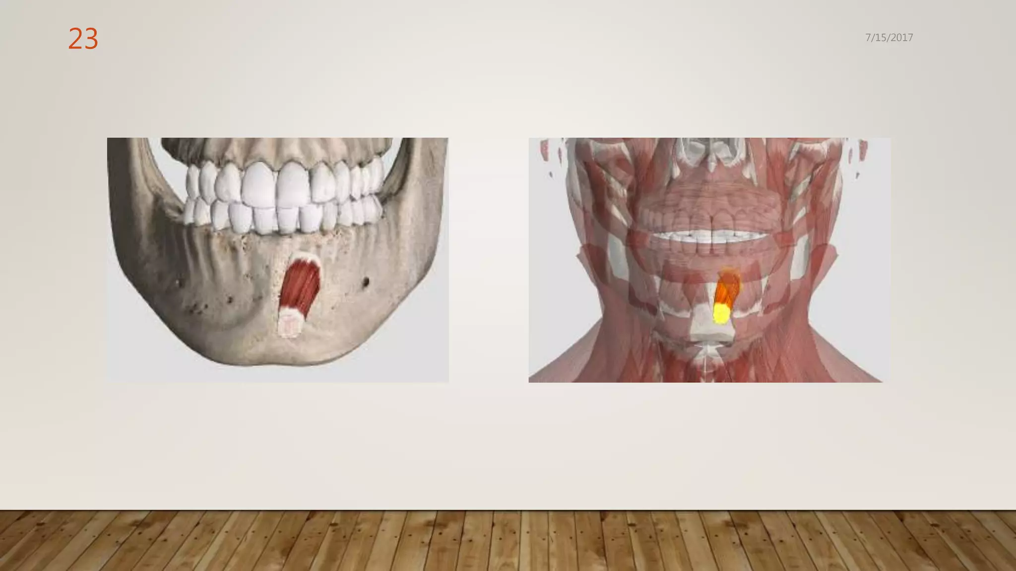 Treatment planning in posterior mandible | PPTX | Dental Health ...