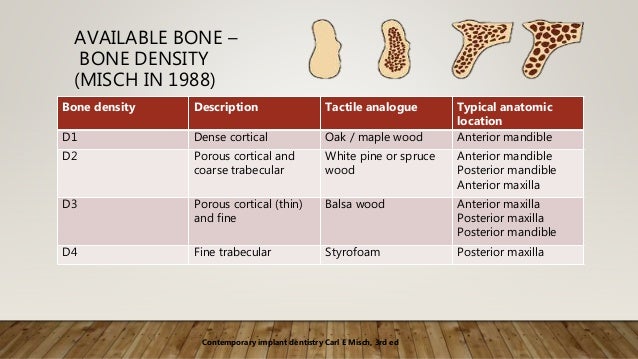 Treatment planning in posterior mandible