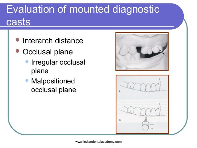 Treatment planning for partially edentulous patients /fixed orthodont…