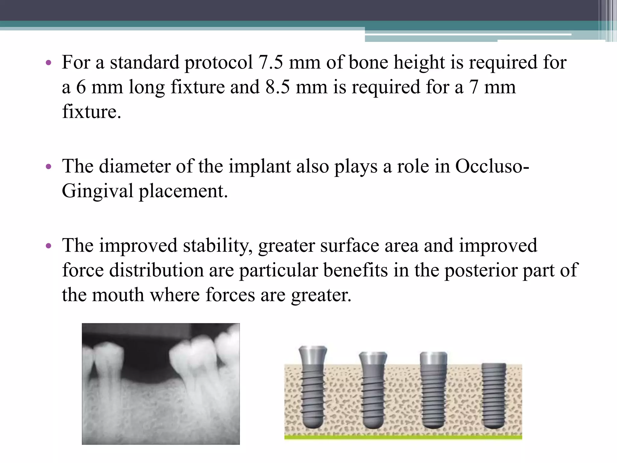 Treatment Planning of Implants in Posterior Quadrants | PPTX