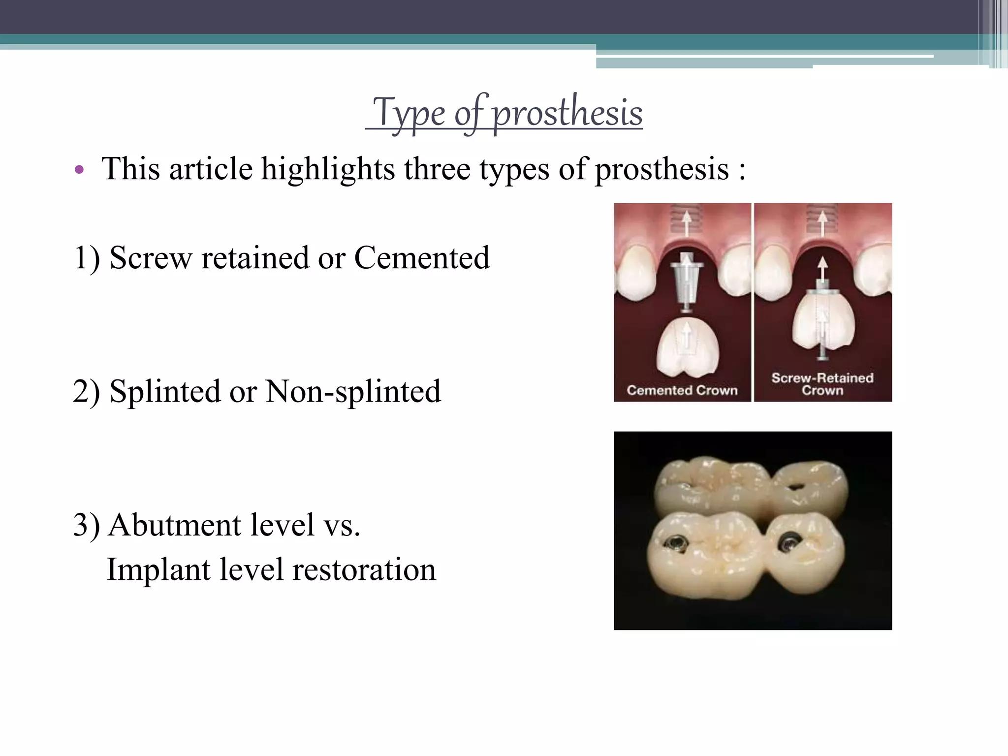 Treatment Planning of Implants in Posterior Quadrants | PPTX
