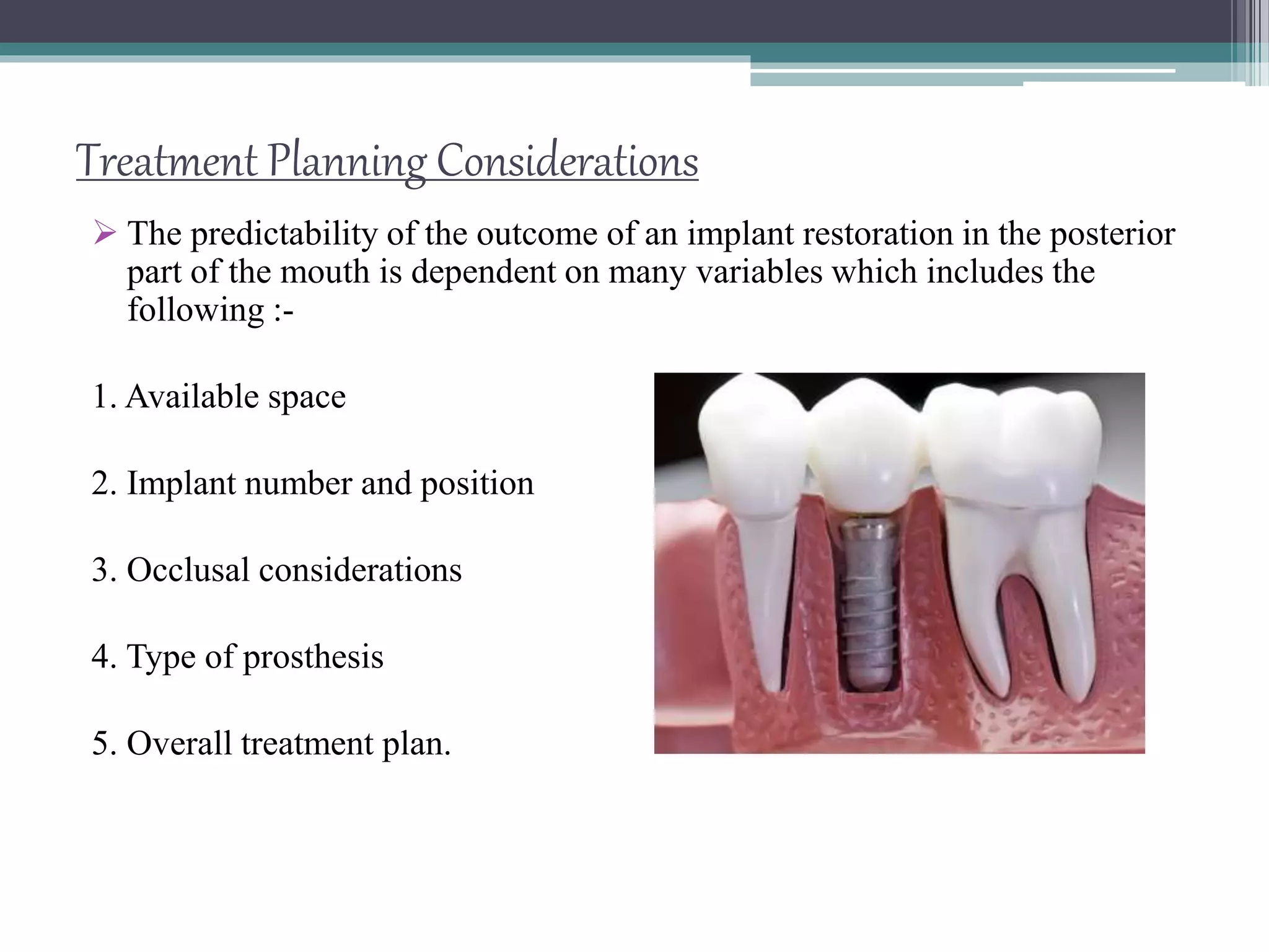 Treatment Planning of Implants in Posterior Quadrants | PPTX