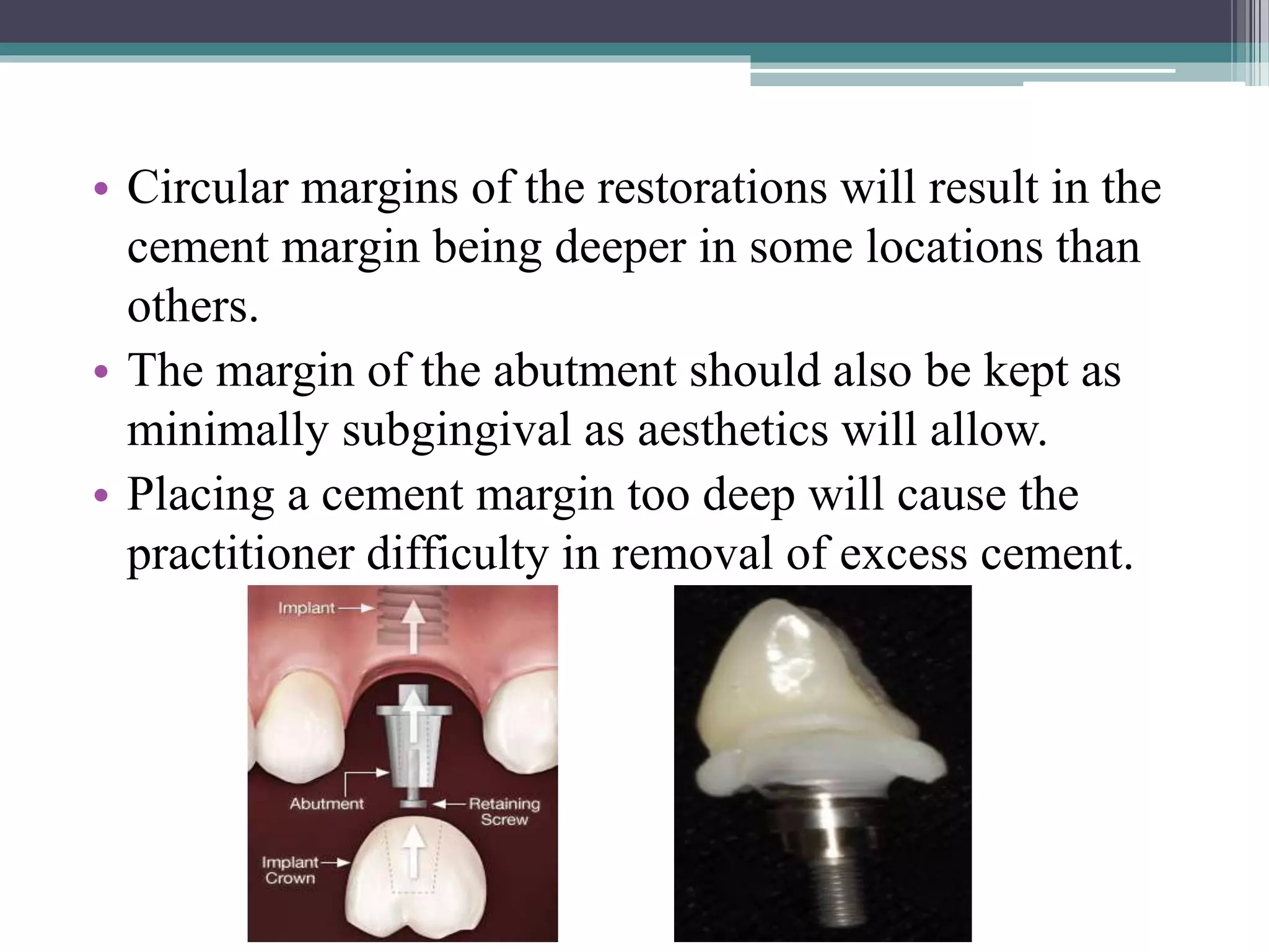 Treatment Planning of Implants in Posterior Quadrants | PPTX