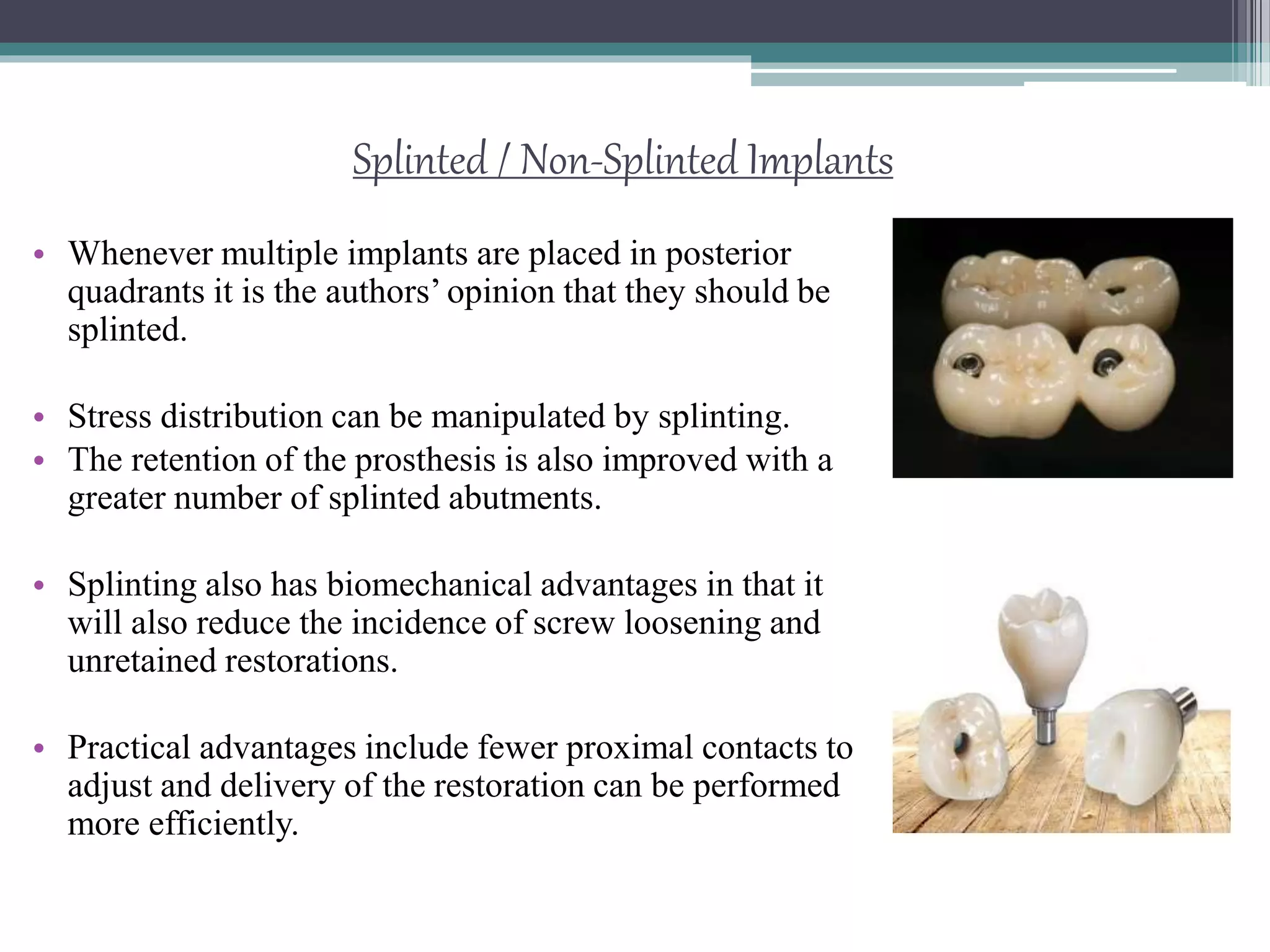 Treatment Planning of Implants in Posterior Quadrants | PPTX