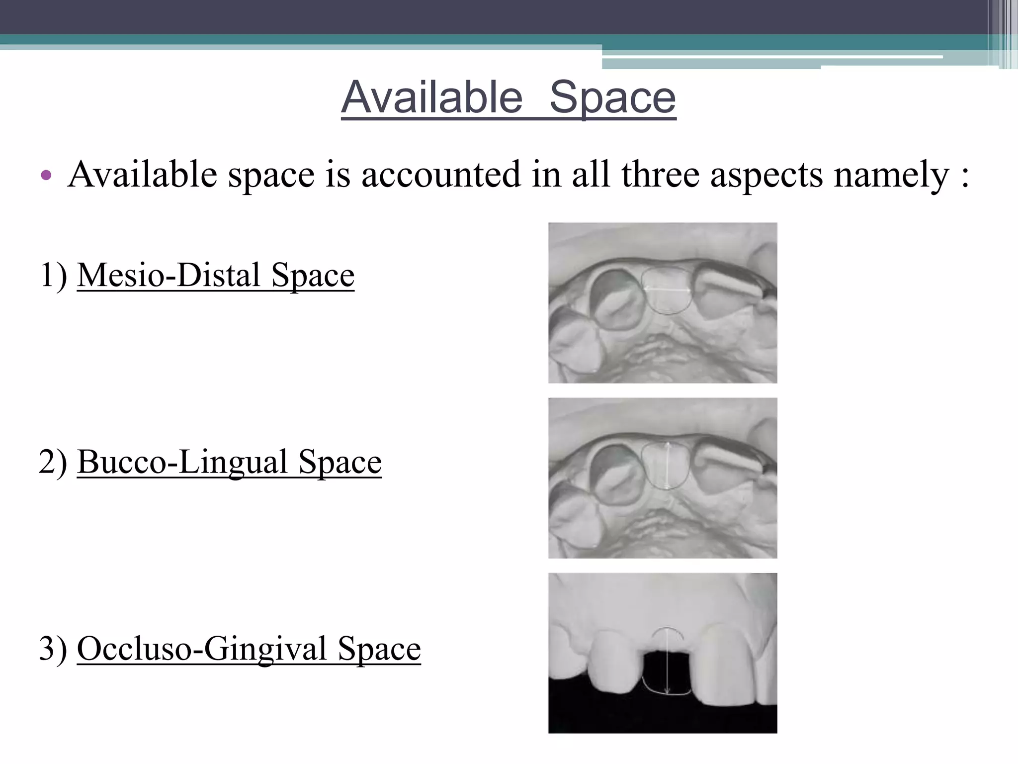 Treatment Planning of Implants in Posterior Quadrants | PPTX
