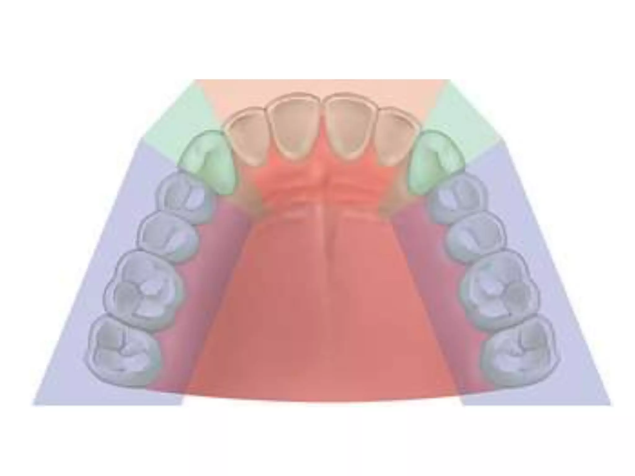 implant placement protocol where and when | PPTX | Bone and Joint ...