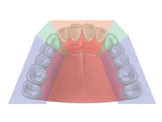 implant placement protocol where and when | PPTX