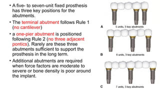 Treatment Plans Related to Key implant position and implant number - Dr ...