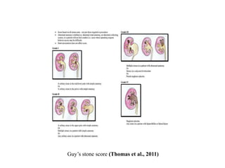 Treatment selection of renal calculi | PPTX | Surgery | Medical Health