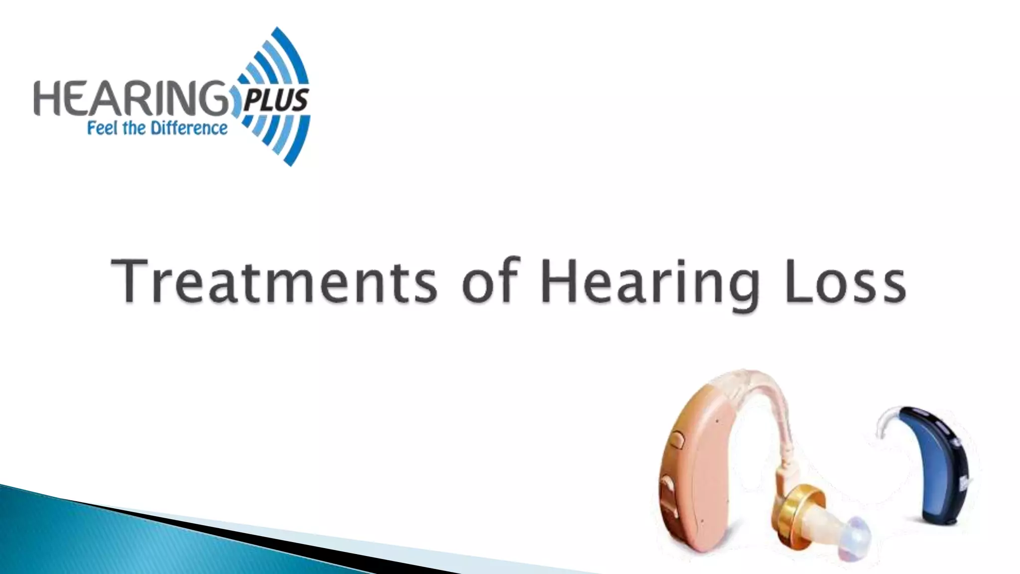 Treatments of Hearing Loss | PPTX