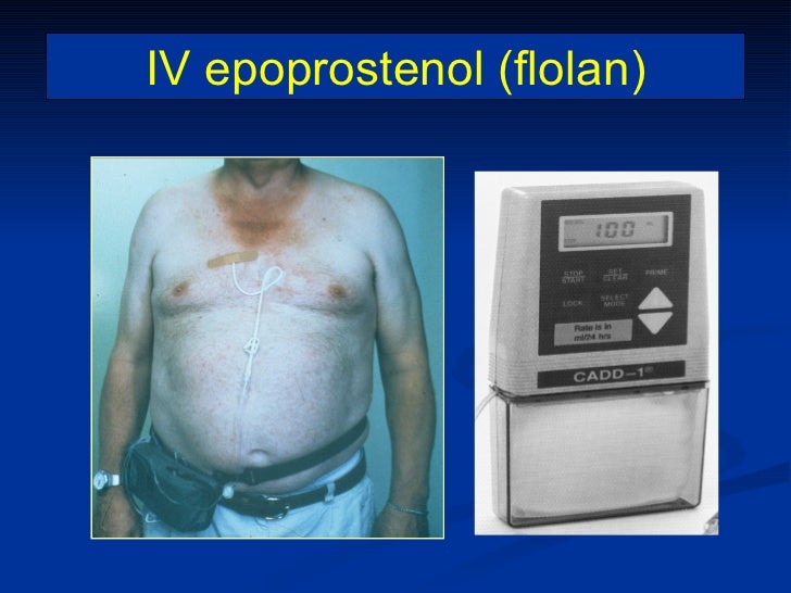 Treatment strategies for pulmonary hypertension
