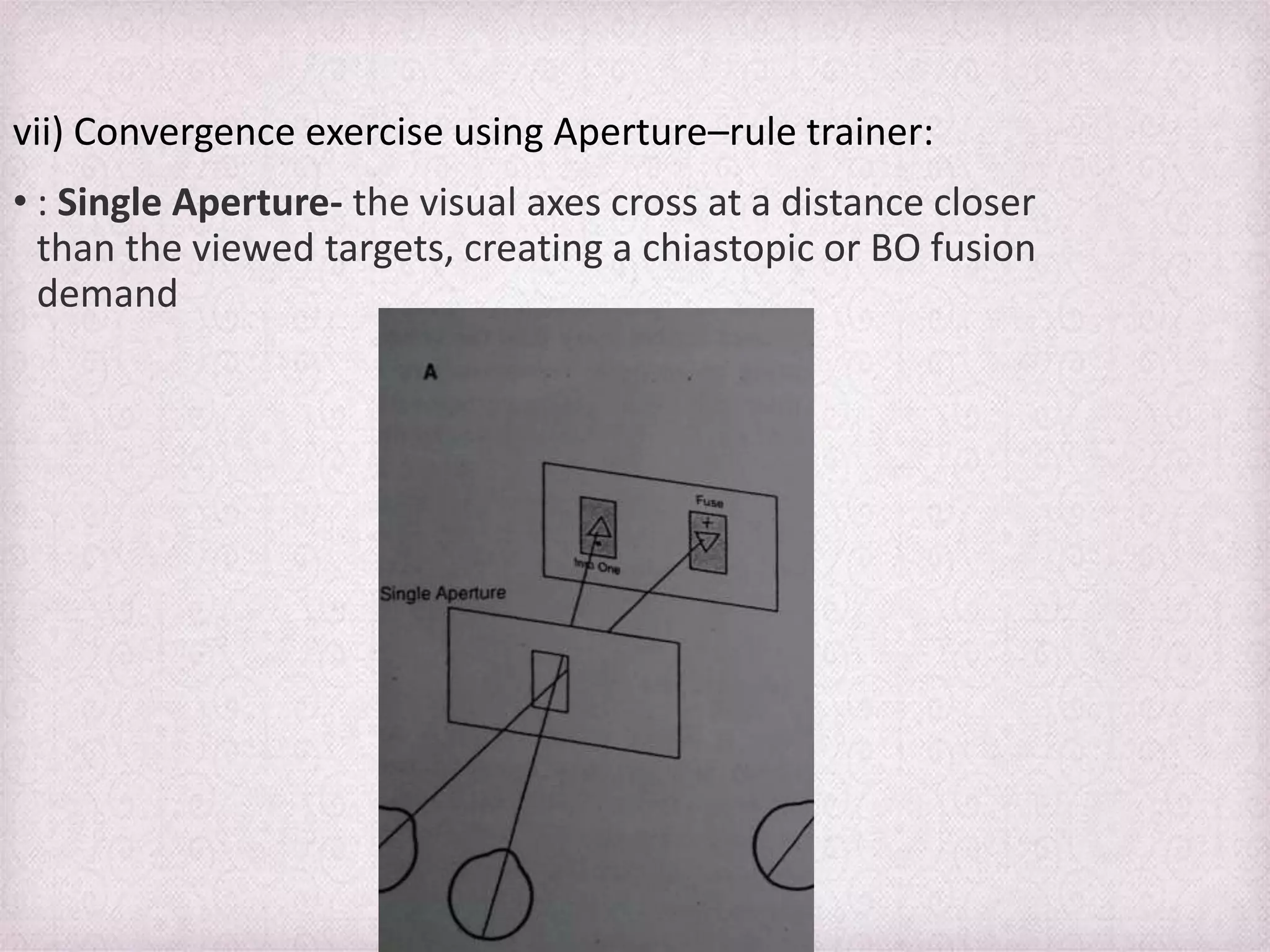 Treatment Strategies for Routine Binocular Vision Problems | PPTX
