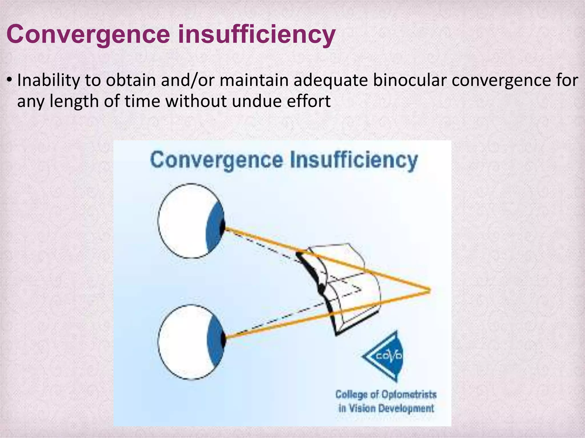 Treatment Strategies for Routine Binocular Vision Problems | PPTX