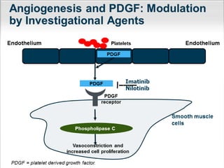 Treatment strategies in pht | PPTX | Lung and Respiratory Health ...
