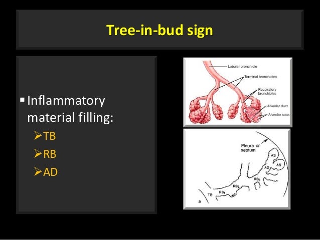 Tree in-bud sign golden s sign