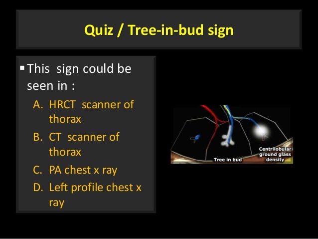 Tree in-bud sign golden s sign