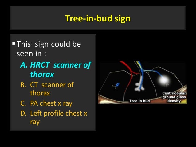 Tree in-bud sign golden s sign
