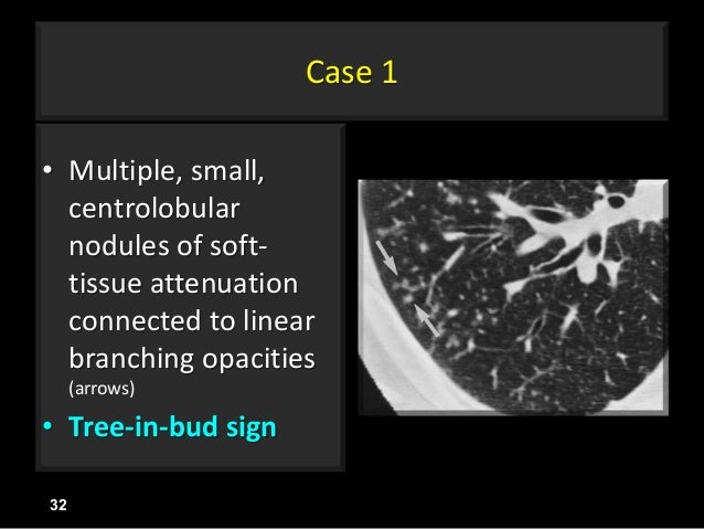 Tree in-bud sign golden s sign