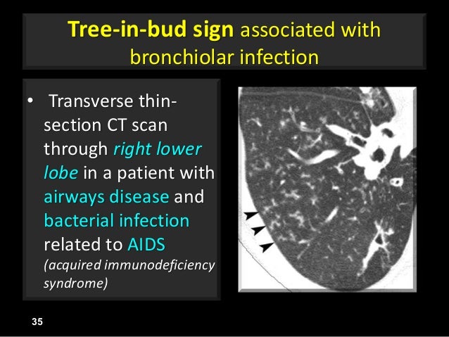 Tree in-bud sign golden s sign