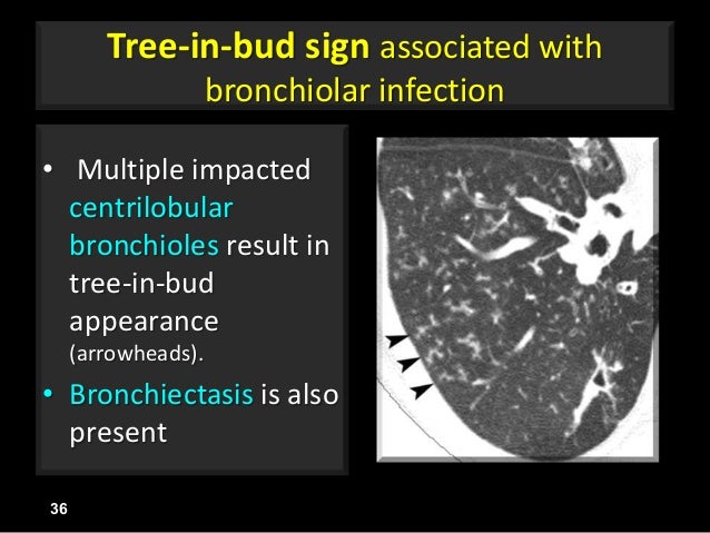 Tree in-bud sign golden s sign