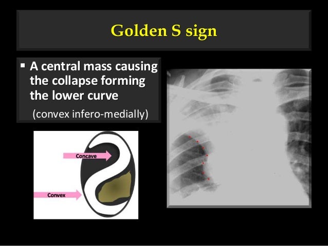 Tree in-bud sign golden s sign