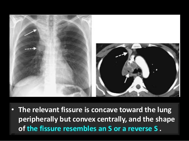 Tree in-bud sign golden s sign