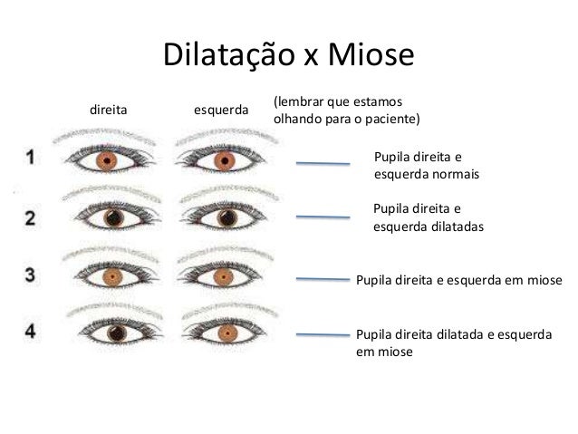 Treinamento circulante