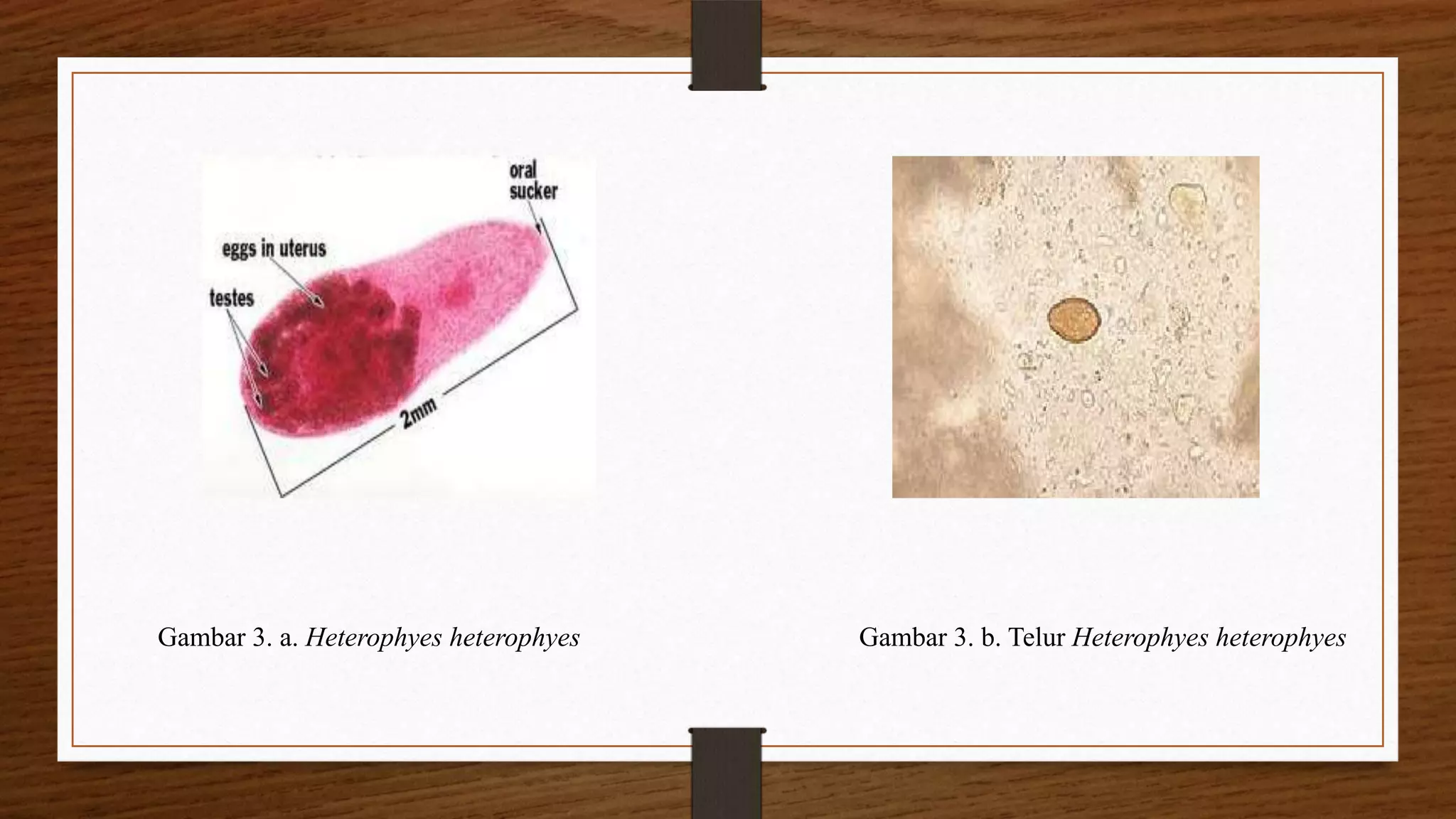 Trematoda usus | PPTX