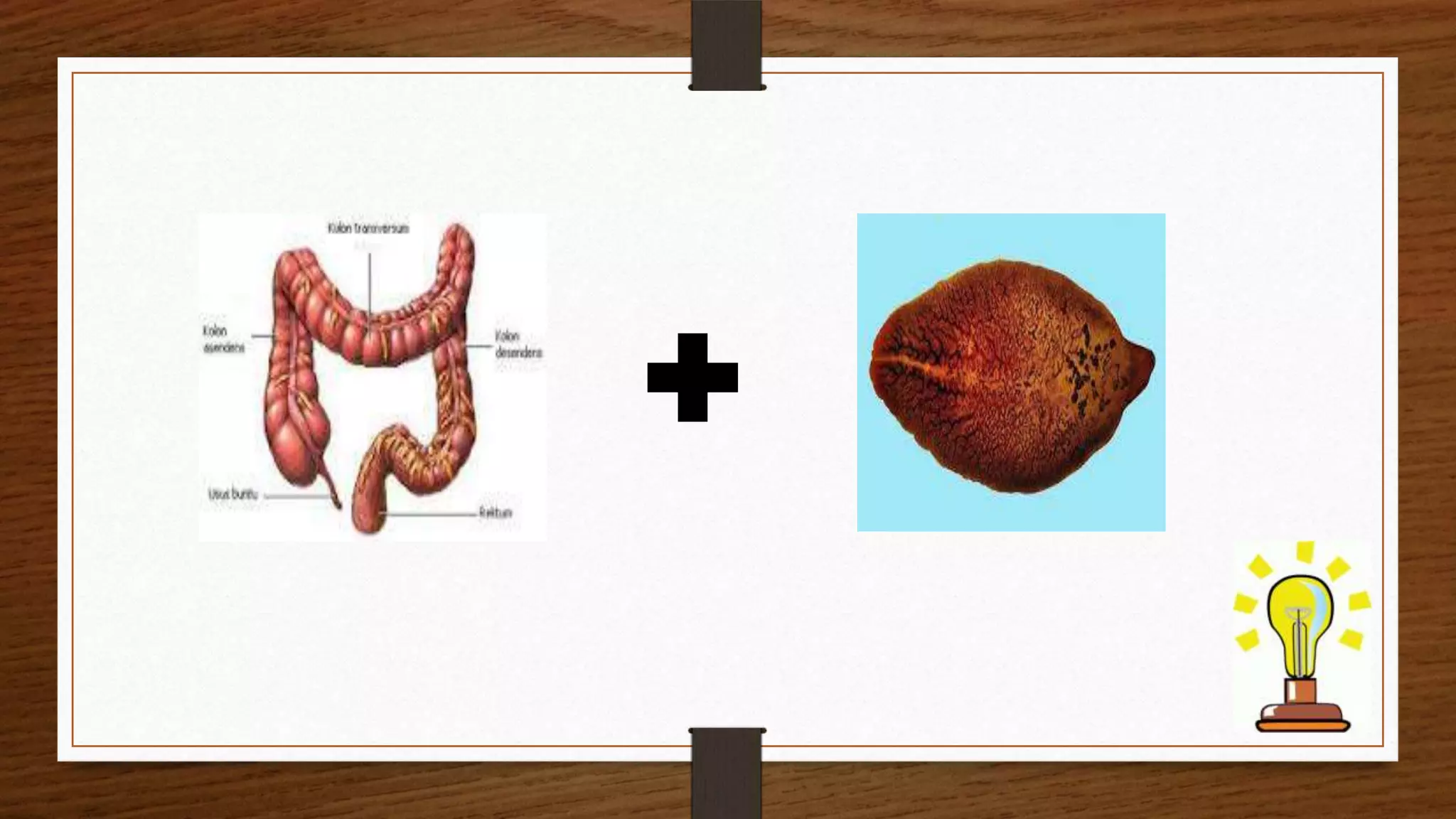 Trematoda usus | PPTX