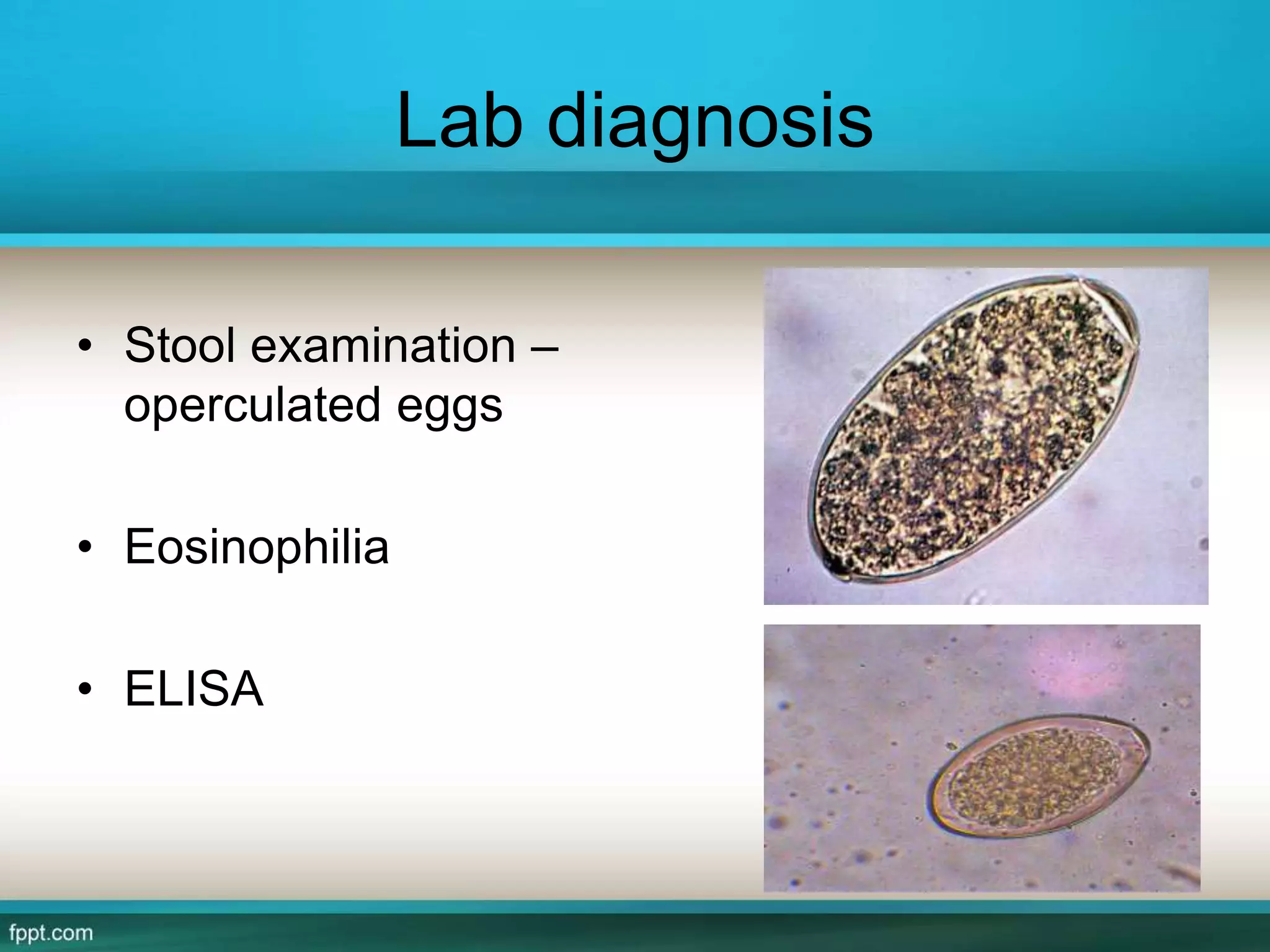 Trematodes by Dr. Rakesh Prasad Sah | PPTX