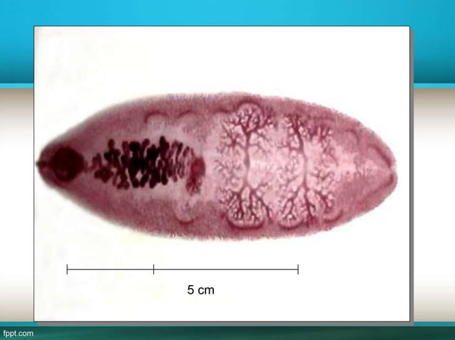 Trematodes by Dr. Rakesh Prasad Sah | PPTX