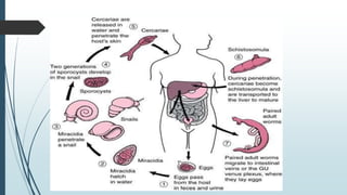 TREMATODES.pptx