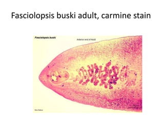 Fasciolopsis Buski Labeled