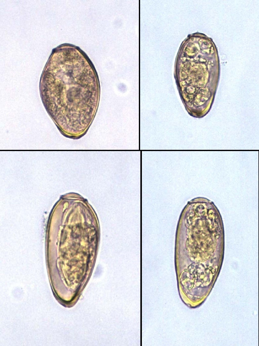 Trematodos