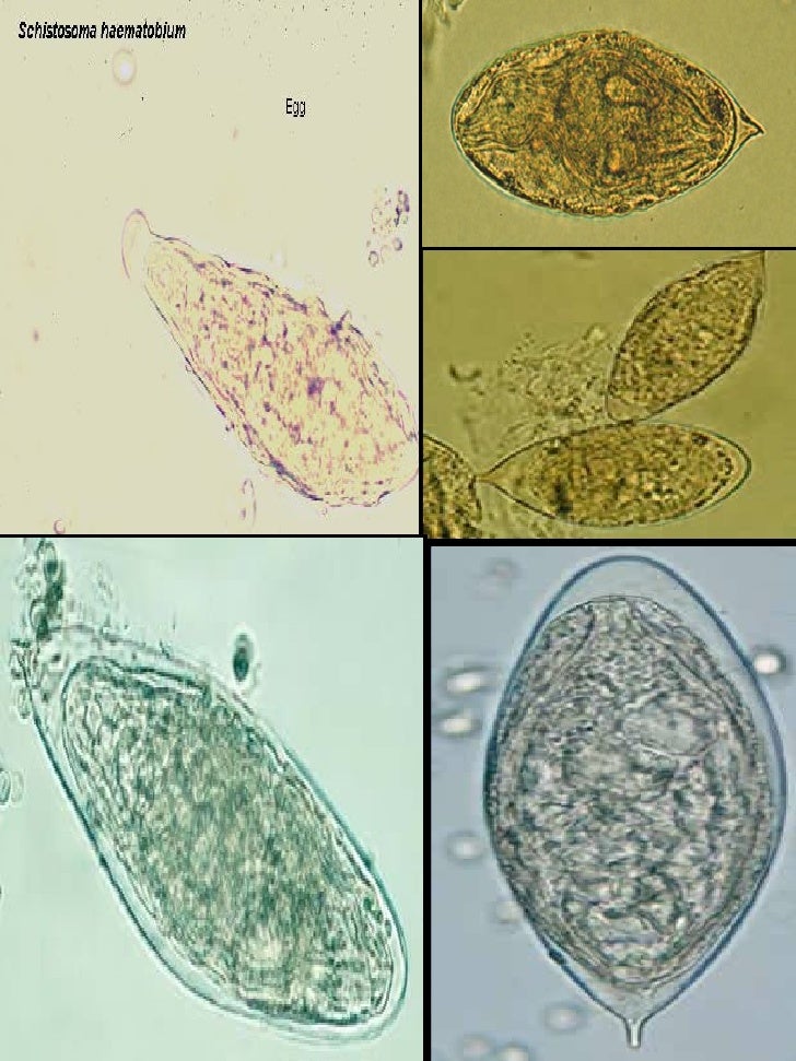 Trematodos