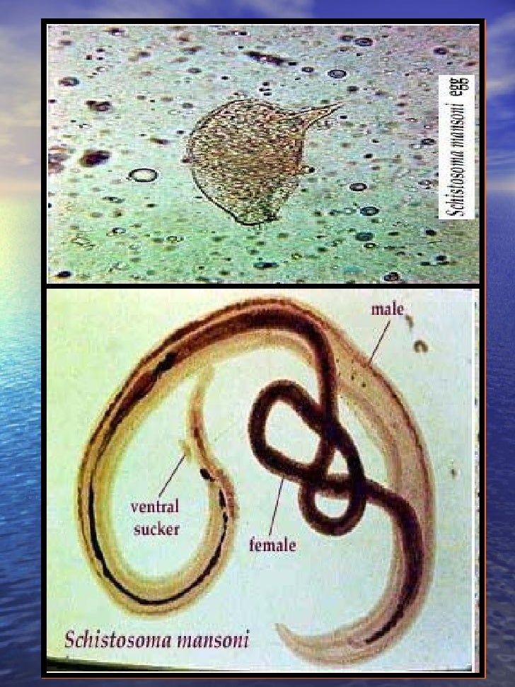 Trematodos