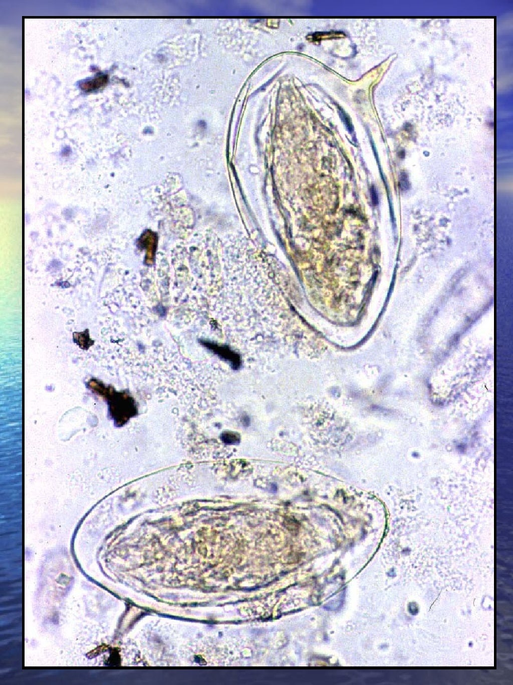 Trematodos
