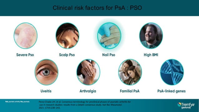 Unveiling Psoriatic Arthritis and the Transformative Role of Guselkumab ...