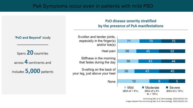 Unveiling Psoriatic Arthritis and the Transformative Role of Guselkumab ...
