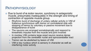 Management of Tremor | PPTX