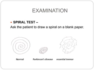 TREMORS and examination by dr abhishri pg2 | PPT